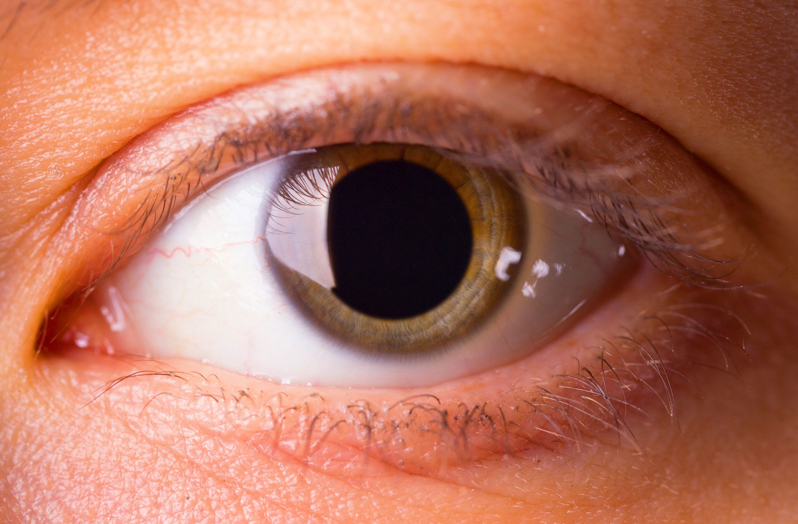 Eye Care Specialist in St. Louis | Hill Vision Services